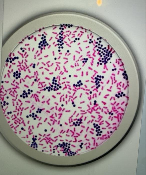 Solved . a. blue; bacilli b.blue; cocci cred; cocci d. | Chegg.com