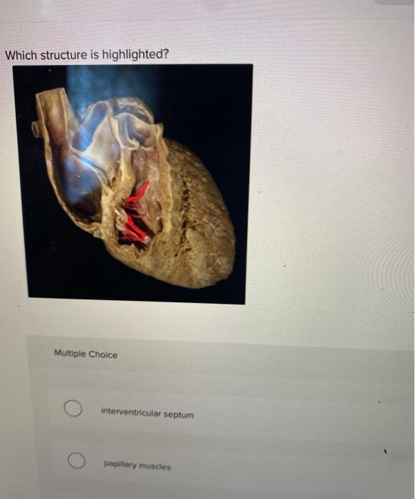 Solved Which structure is highlighted? Multiple Choice | Chegg.com