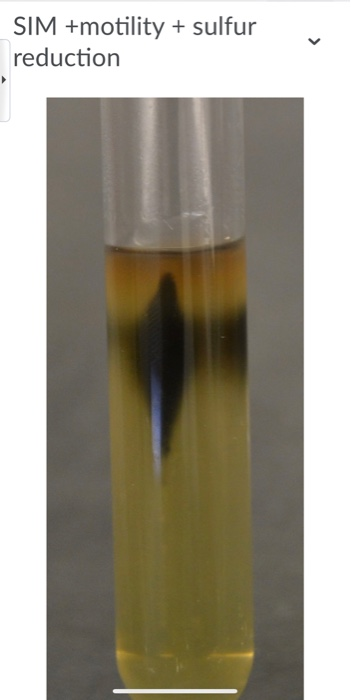 Solved SIM +motility + sulfur reduction | Chegg.com