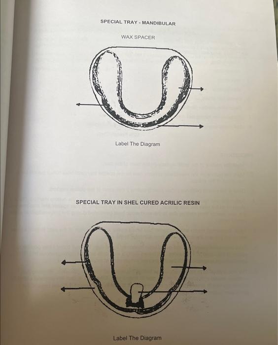 PRIMARY CAST - MAXILLARY T SHAPED SHELLAC SPACER | Chegg.com