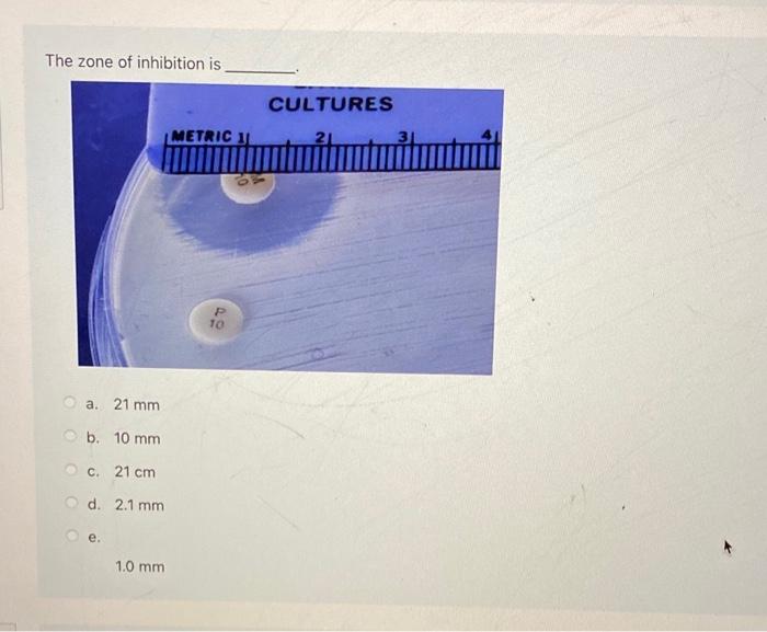 Solved Place the steps of the Kirby Bauer method of | Chegg.com