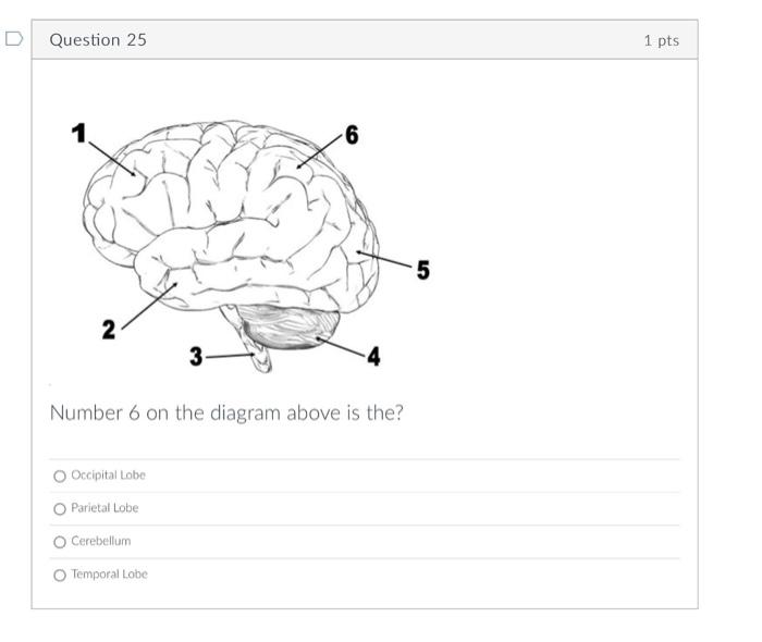 Solved Number 1 in the diagram above is the? Temporal Lobe | Chegg.com