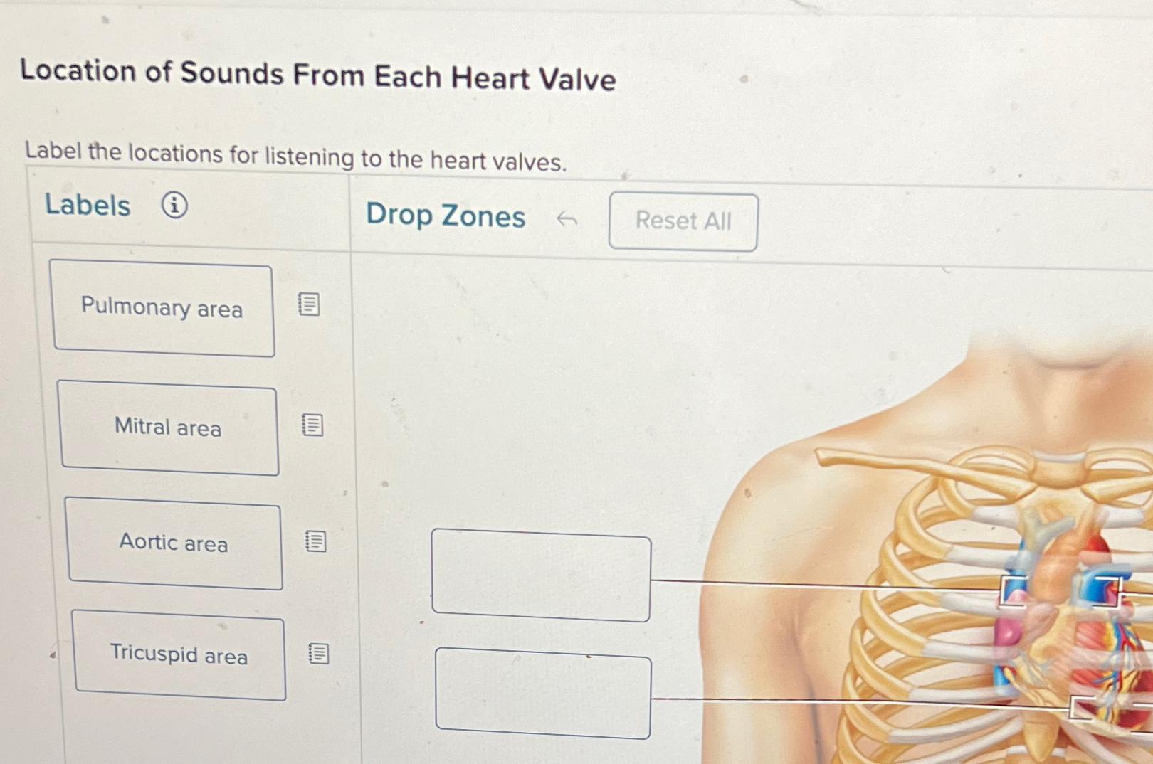 Solved Location of Sounds From Each Heart ValveLabel the | Chegg.com