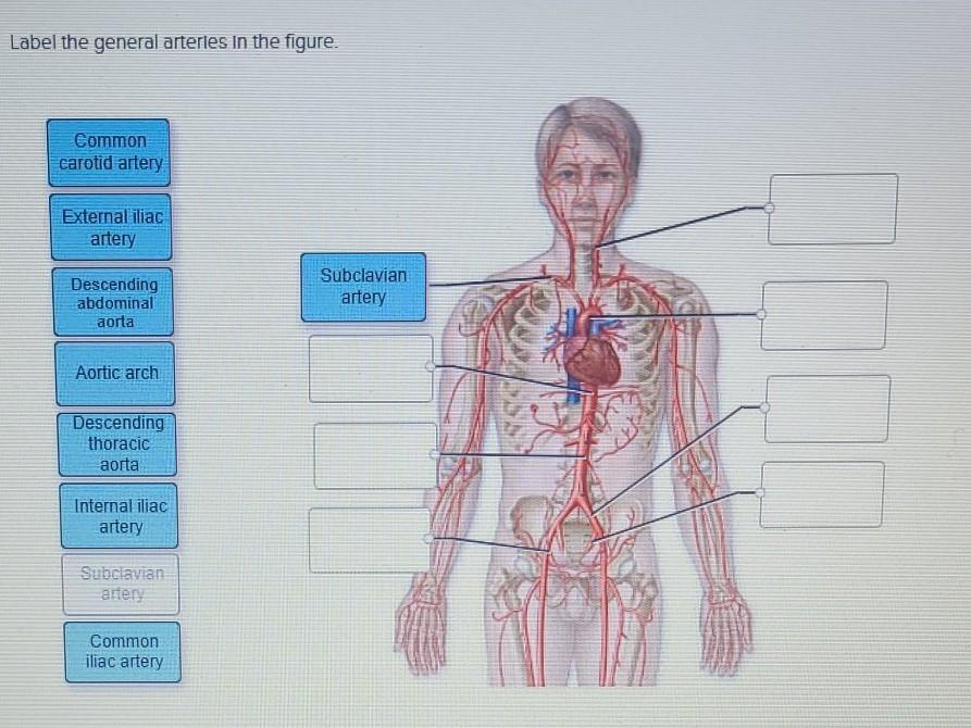 Solved Label the general arteries in the figure. Common | Chegg.com