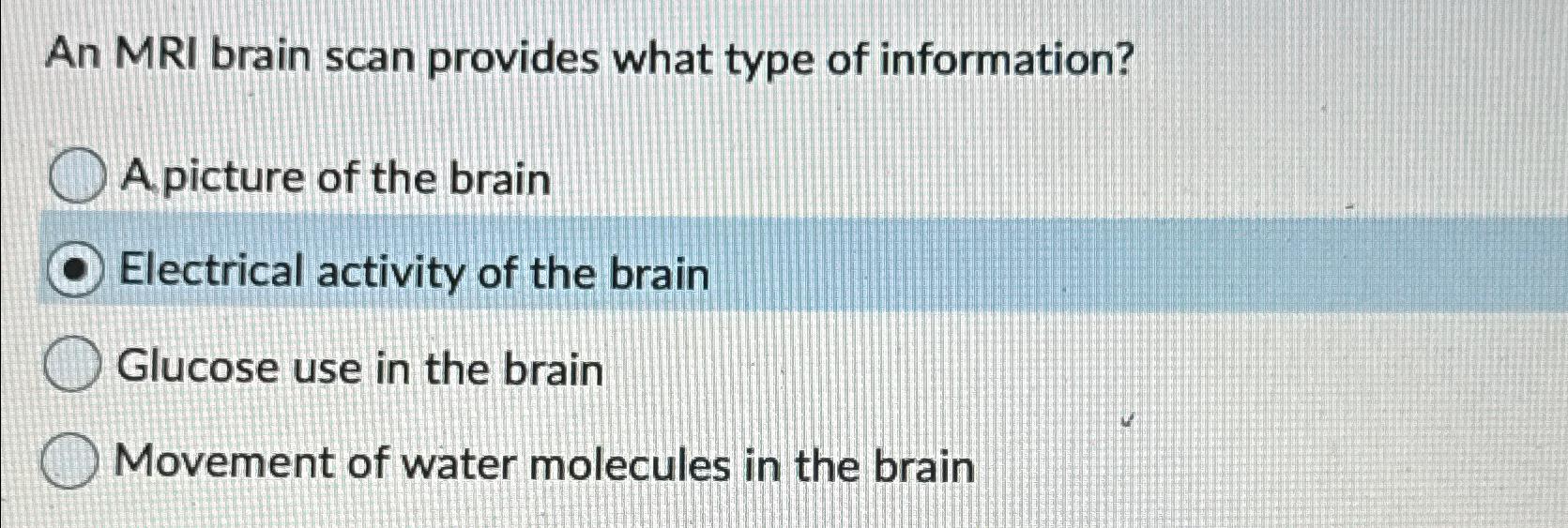 Solved An MRI brain scan provides what type of information?A | Chegg.com