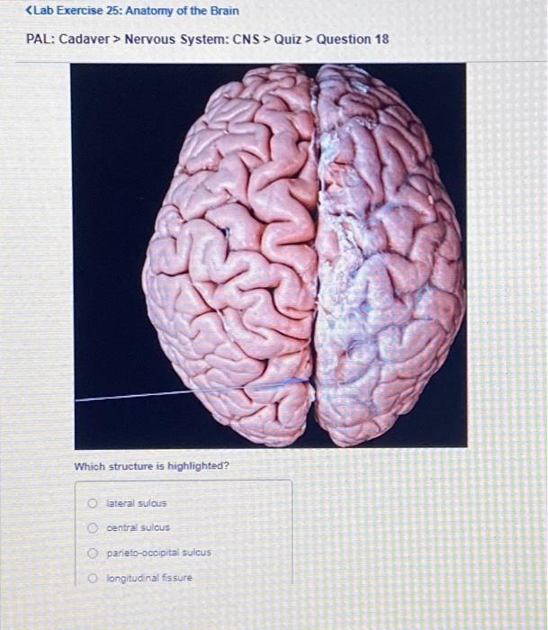 Solved Nervous System: CNS > Quiz > Question 19 Which | Chegg.com
