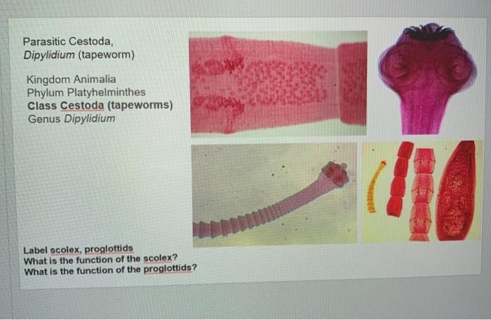 Solved Dugesia (planarian) c.s., 100x free-living | Chegg.com