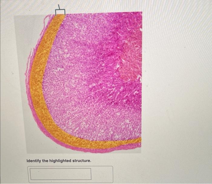 Solved Identify the highlighted structure. Identify the | Chegg.com