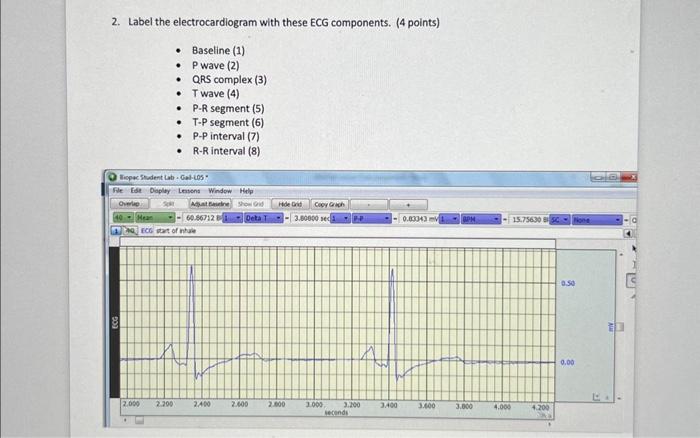 Solved 2. Label the electrocardlogram with these ECG | Chegg.com