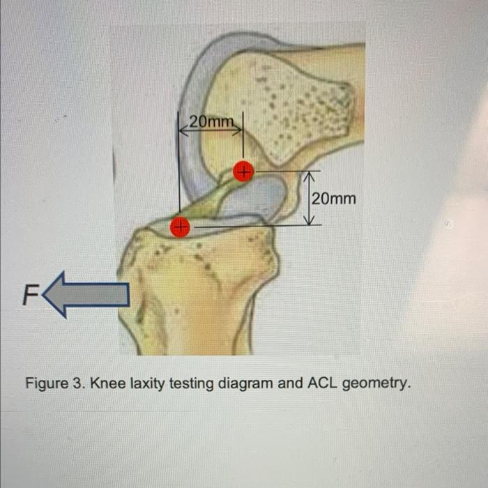Solved Testing of knee laxity is a common procedure to | Chegg.com