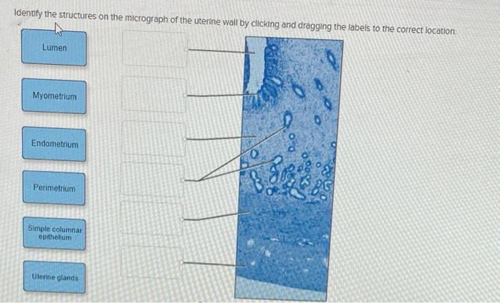 Solved Identify the structures on the micrograph of the | Chegg.com