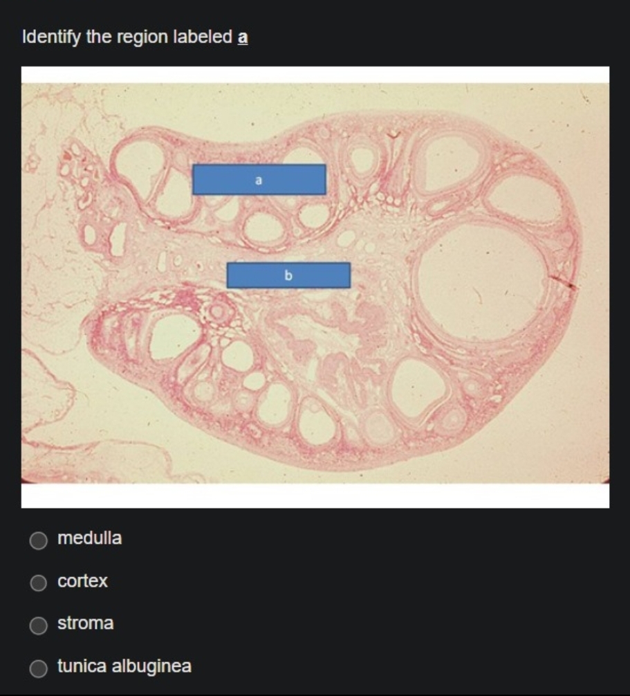 Solved Identify the region labeled amedullacortexstroma | Chegg.com