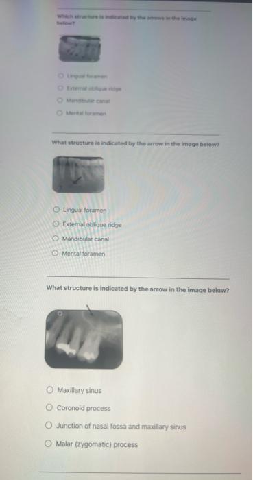 Solved What structure is indicated by the arrow in the image | Chegg.com
