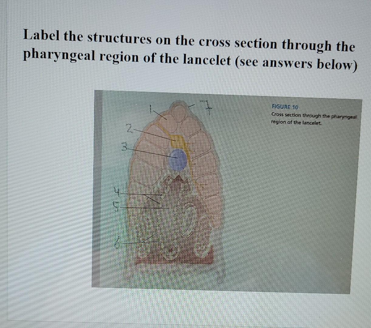 Solved Label the structures on the cross section through the | Chegg.com