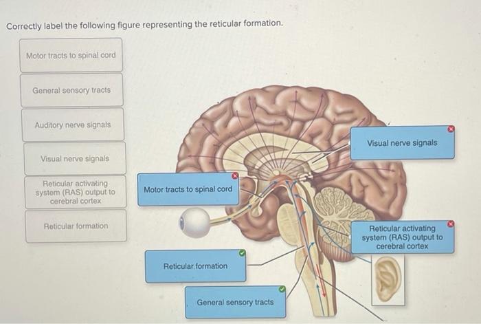 Solved Correctly label the following figure representing the | Chegg.com