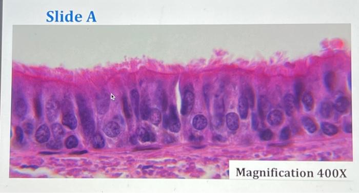 Solved Slide F Magnification 1000X Hint: this is not an | Chegg.com