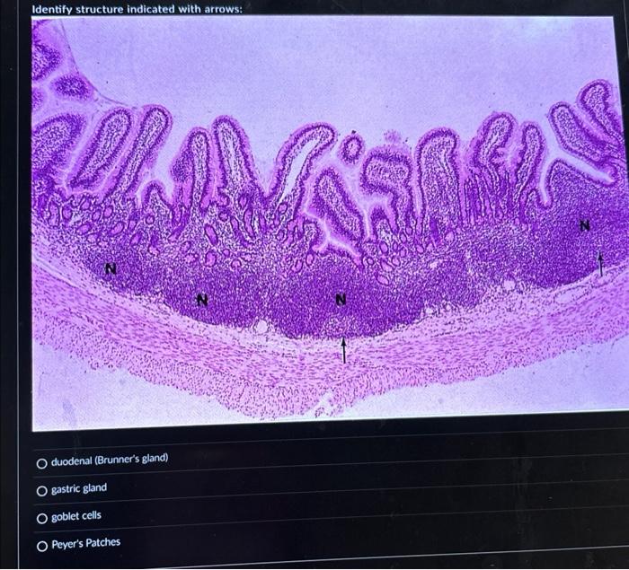 Solved Identify structure indicated with arrows: duodenal | Chegg.com
