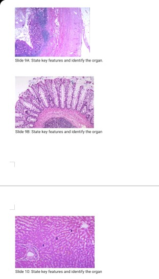 Solved Slide 9A State key features and identify the organ | Chegg.com