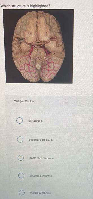 Solved Which structure is highlighted? Multiple Choice O | Chegg.com
