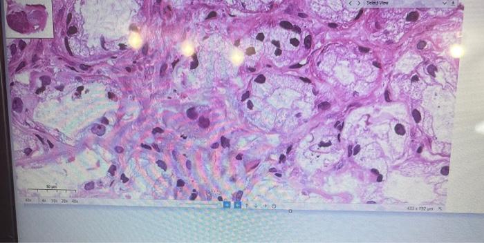 Solved 1. label mucus acinus, cell of mucus acinus and duct | Chegg.com