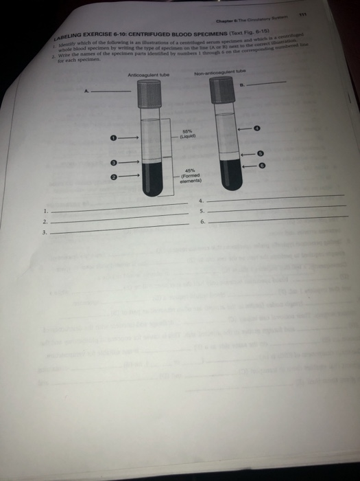 Solved FLING EXERCISE 6-10 CENTRIFUGED BLOOD C E -15) Atb | Chegg.com