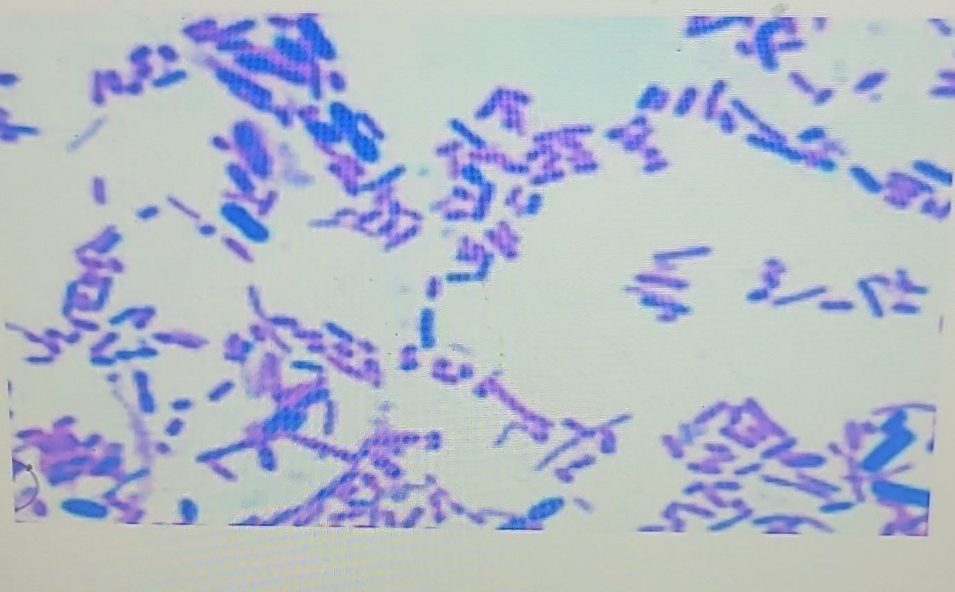 Solved can someone please help me identify my two organisms? | Chegg.com