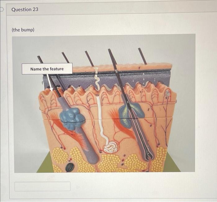 Solved Question 23 (the bump) Name the feature CA D | Chegg.com