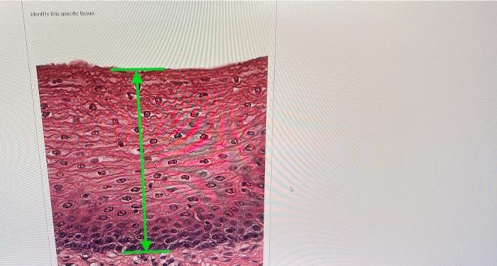 Solved identify this specific tissue. | Chegg.com