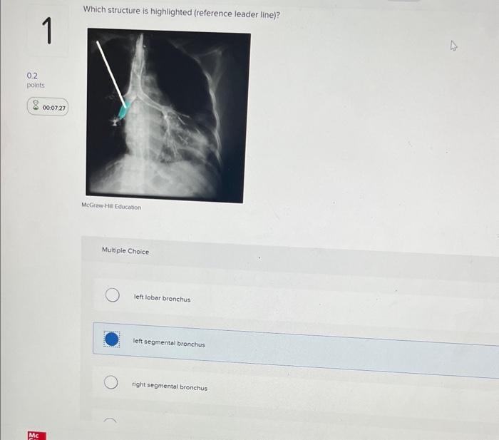 Solved Which structure is highlighted (reference leader | Chegg.com