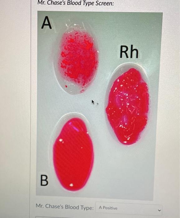 Solved First Child's Blood Type Screen: A Rh B First Child's | Chegg.com