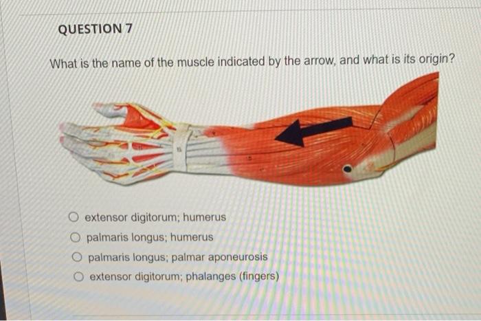 Solved What is the name of the muscle indicated by the | Chegg.com