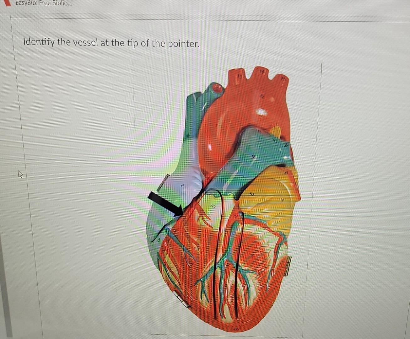 Solved dentify the structure at the tip of the | Chegg.com