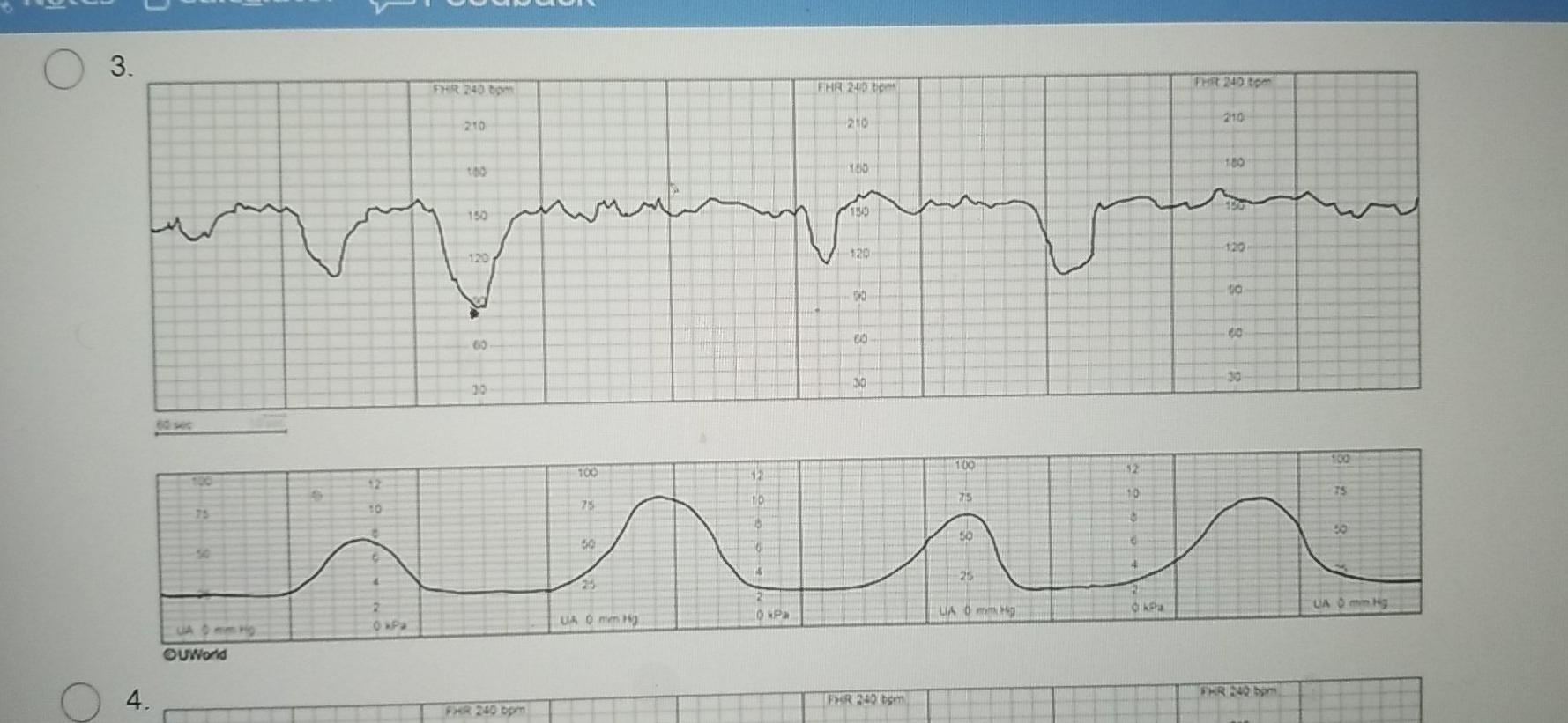 Solved A nurse is caring for a client at 37 weeks gestation | Chegg.com