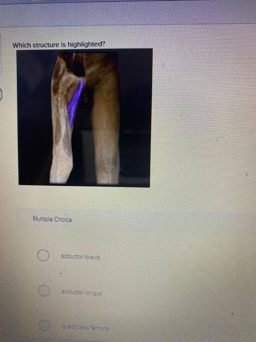 Solved Which structure is highlighted? Multiple Choice | Chegg.com