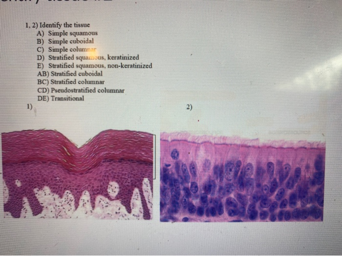 Solved 1, 2) Identify the tissue A) Simple squamous B) | Chegg.com