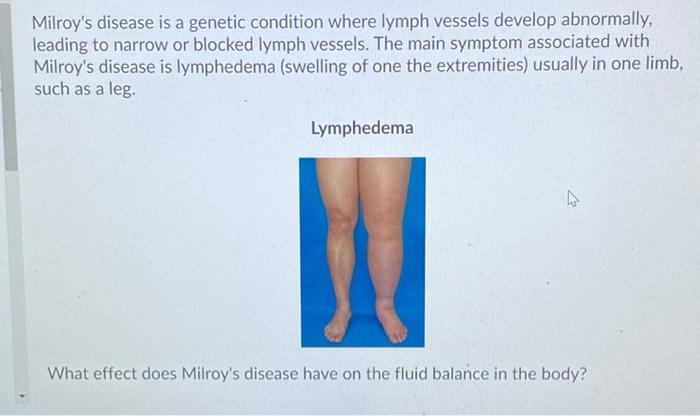 Solved Milroy's disease is a genetic condition where lymph | Chegg.com