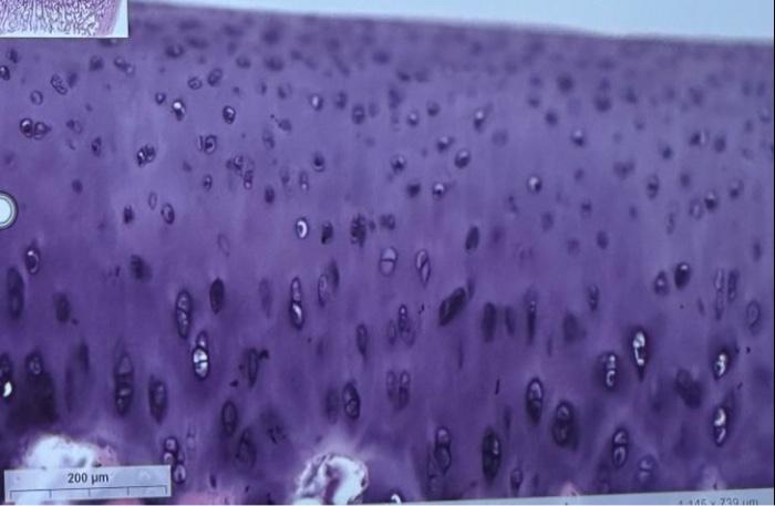 Solved name and label the nucleus , type of bone/cartilage , | Chegg.com