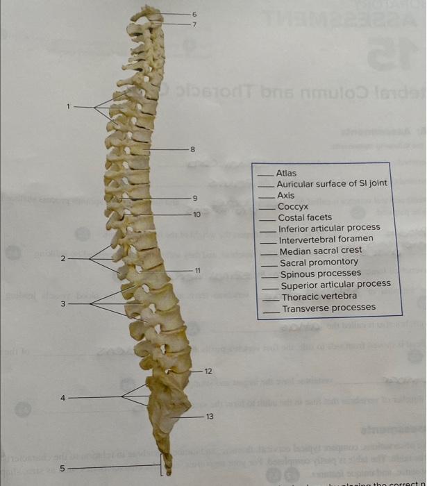 Solved Atlas Auricular surface of SI joint Axis Coccyx | Chegg.com