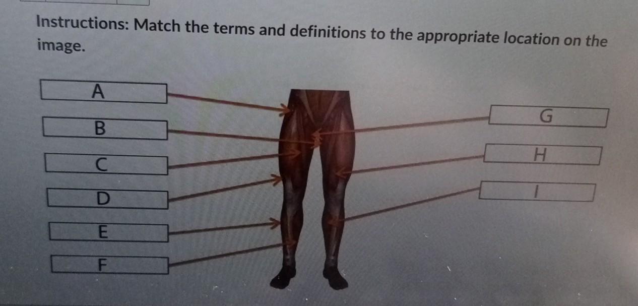 Solved Instructions: Match the terms and definitions to the | Chegg.com