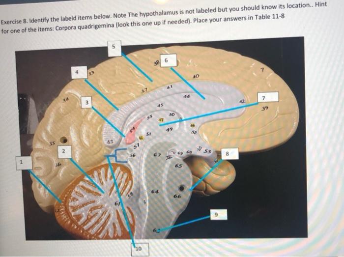 Solved Exercise 8. Identify the labeld items below. Note The | Chegg.com