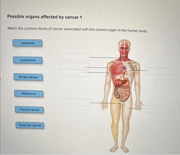 Solved Possible organs affected by cancer 1 Match the common | Chegg.com