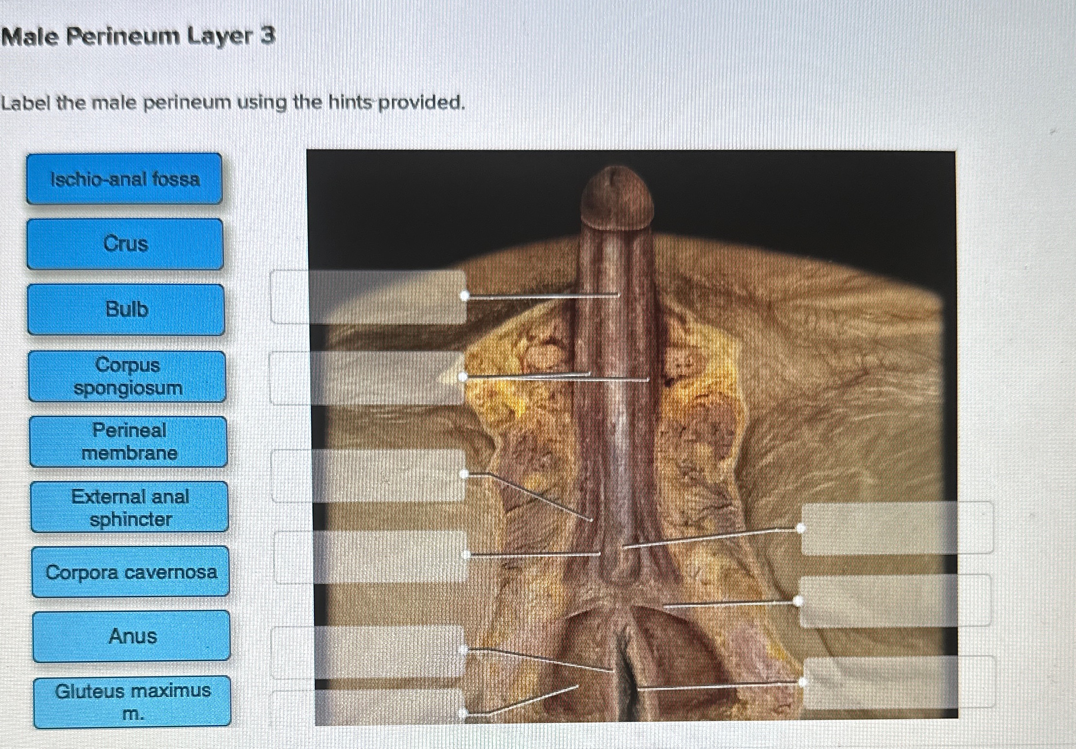 Solved Male Perineum Layer 3Label the male perineum using | Chegg.com