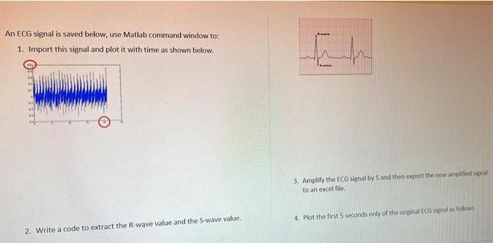 An ECG signal is saved below, use Matlab command | Chegg.com
