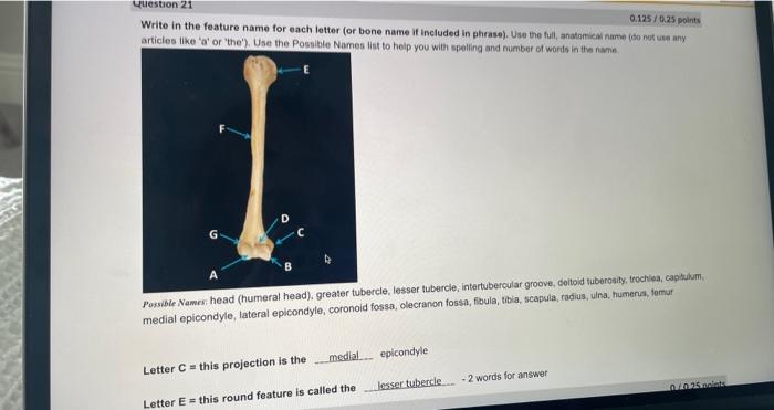 Solved Write in the feature name for each letter (or bone | Chegg.com