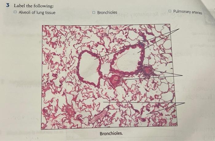 Solved 3 Label the following: ㅁ Alveoli of lung tissue | Chegg.com