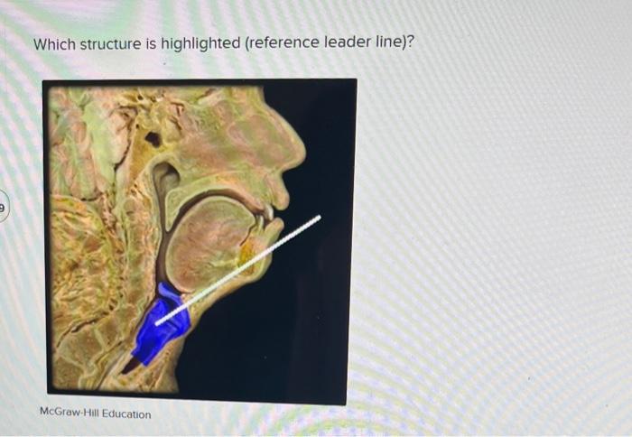 Solved Which structure is highlighted (reference leader | Chegg.com
