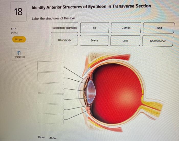 Solved Identify Anterior Structures of Eye Seen in | Chegg.com
