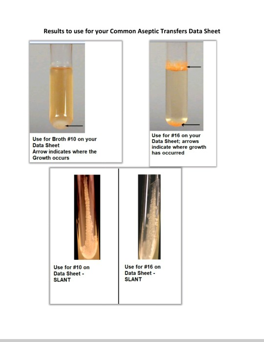 Solved Dale DATA SHEET 1-4 Common Aseptic Transfers and | Chegg.com