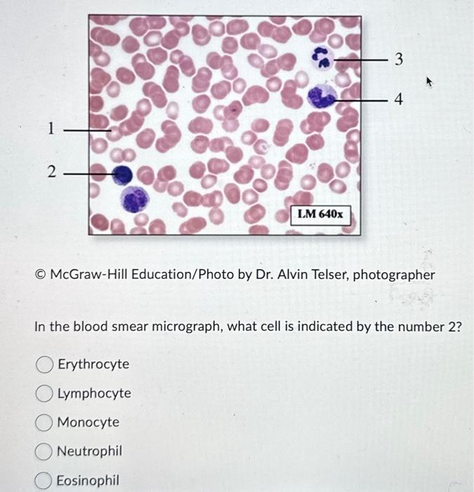 Solved im the blood smear micrograph what cell is indicated | Chegg.com
