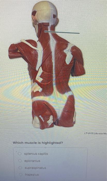 Solved The deltoid is responsible for: extending the | Chegg.com